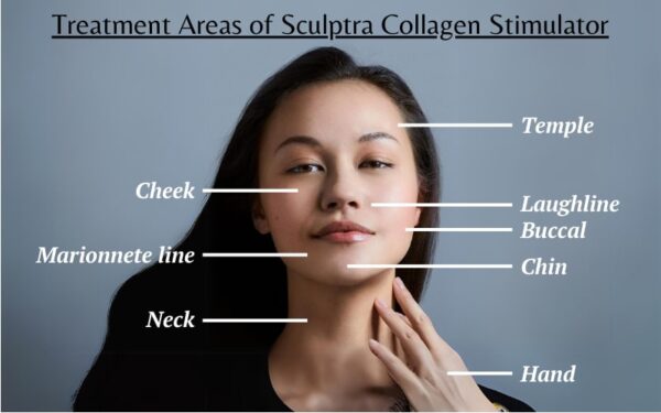 Prevent Face Overfilled Syndrome with Sculptra Collagen Stimulator